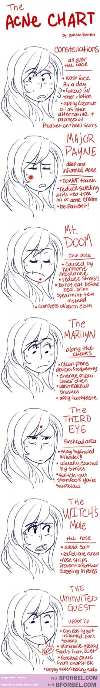 The Acne Chart: was mir mein Pickel sagen will | PuraLiv